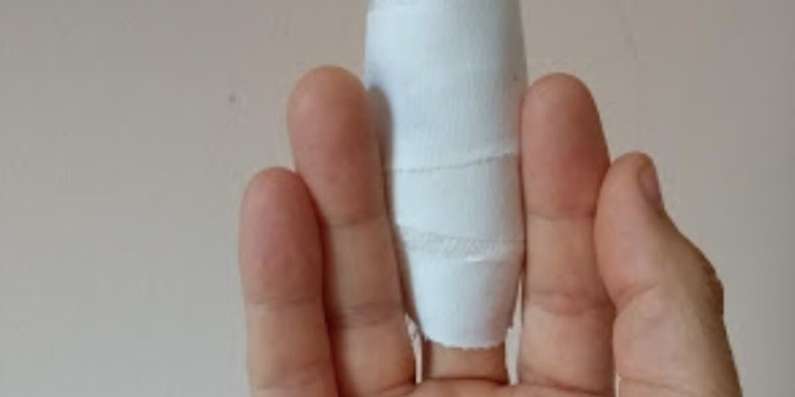 Bărbat ajuns la spital, după ce și-a dat cu toporul peste degetul ...